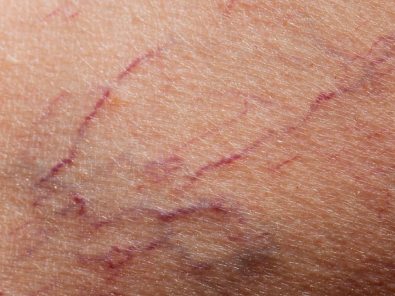 Diagnosing Orthopaedic Injuries with MRI (Magnetic Resonance Imaging ...