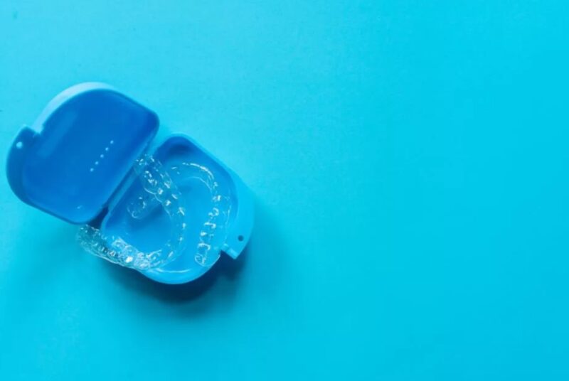 How to Ensure You Gain More from a Retainer - AWS Rails