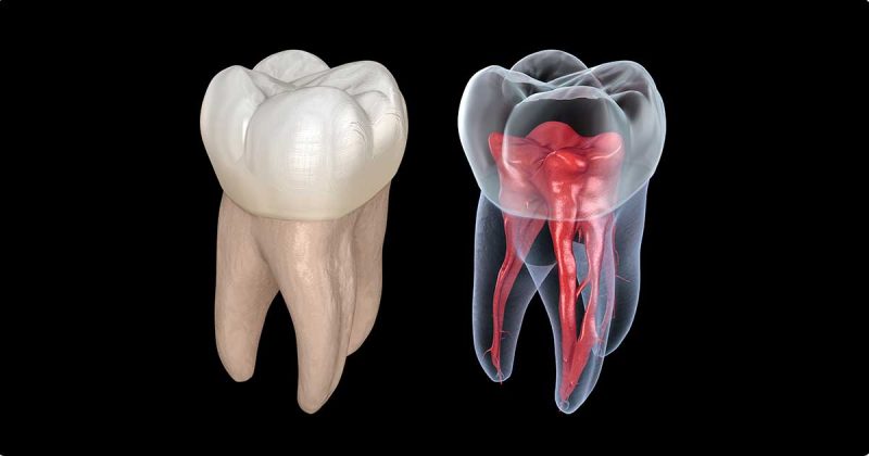 How Much Does a Root Canal Cost With and Without Insurance? - AWS Rails