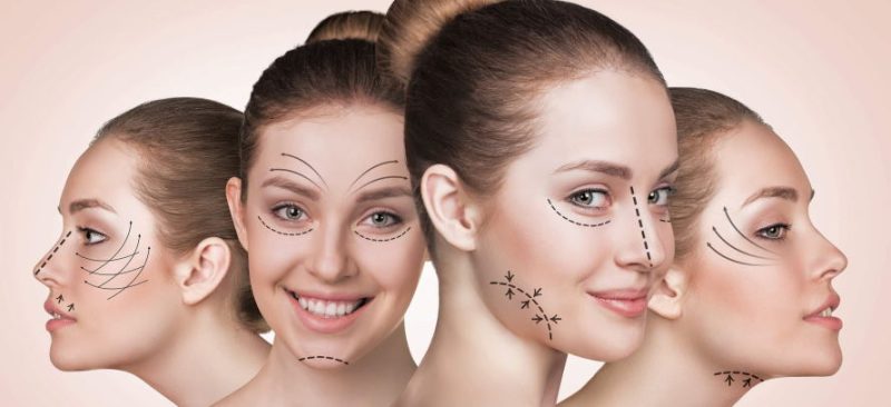 What You Missed About the Plastic Surgery